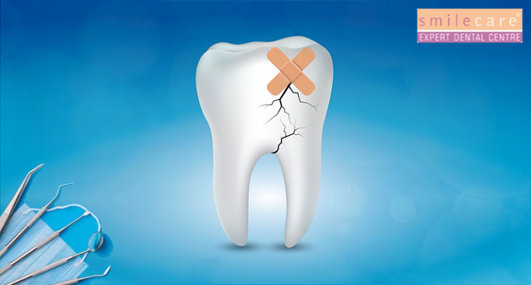 Best Dentist Near in Bandra West, Mumbai | Smile Care India