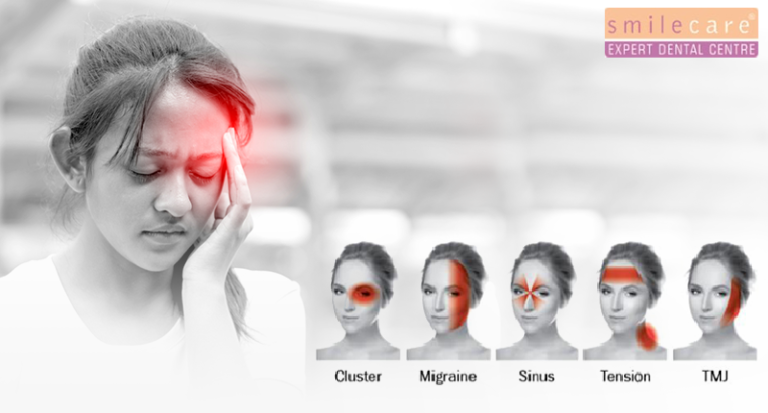 5 Signs Your Headache Might Be Caused by a TMJ Disorder