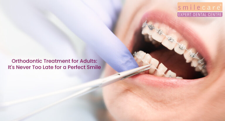 Best Dentist in Bandra West | Dental Clinic in Bandra West | Smile Care ...