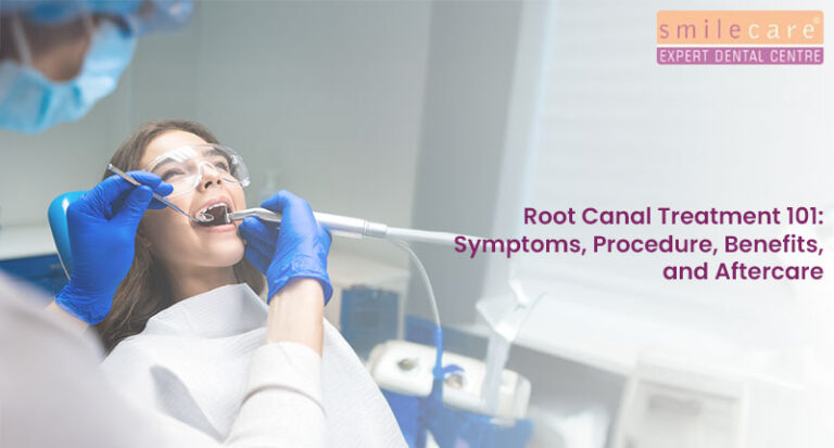 Root Canal Treatment 101: Symptoms, Procedure, Benefits, and Aftercare